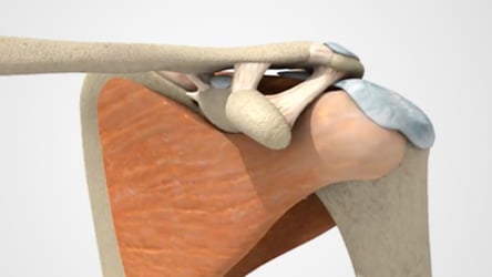 subscapularis impingement test