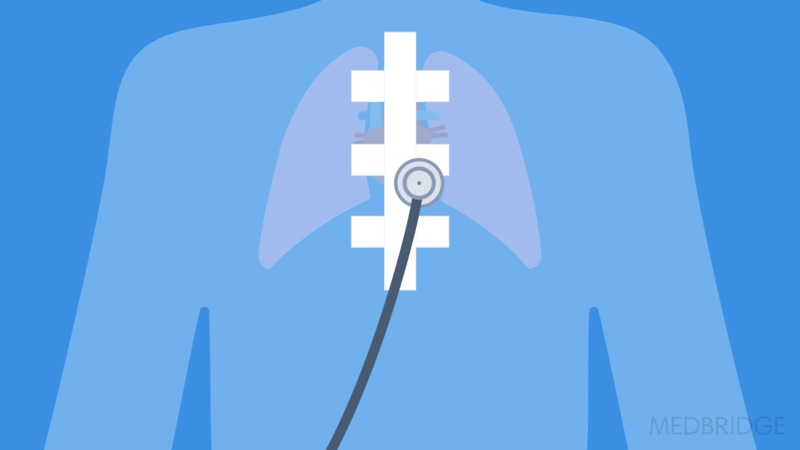 Post CABG Recovery: Nursing Care and Management | Medbridge