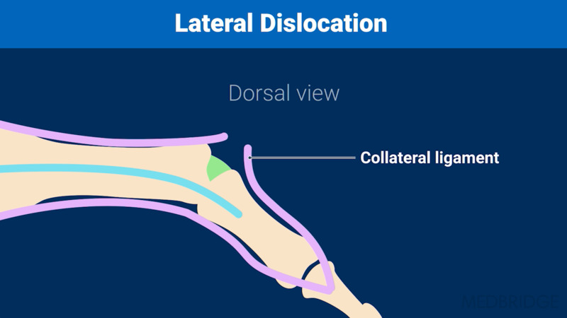 Clinical Management of Industrial Traumatic Hand Injury | Medbridge