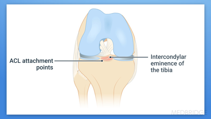 ACL Injury Prevention and Performance Enhancement Program Part 1 | Medbridge