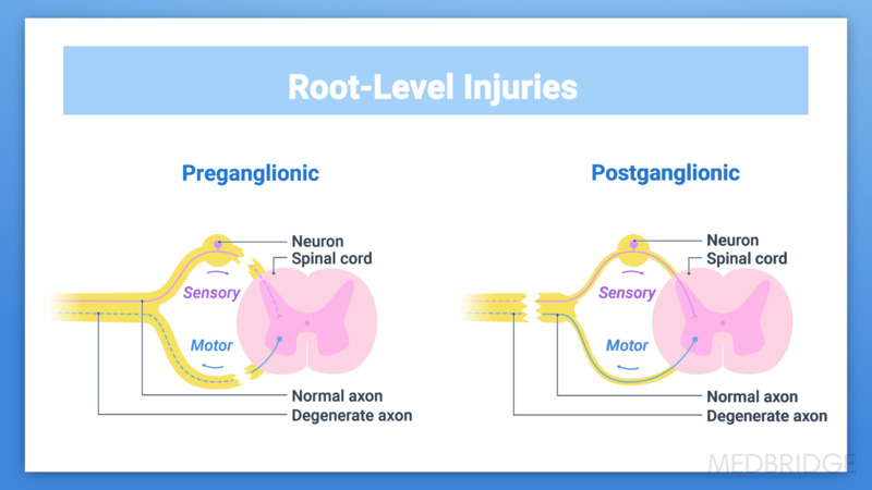 brachial plexus reflexes